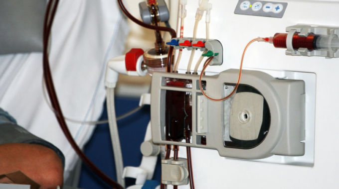 Flow Monitors and Dialysis Machines | ChemTec