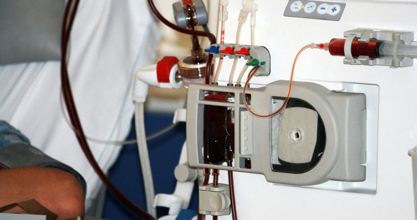 Flow Monitors and Dialysis Machines | ChemTec